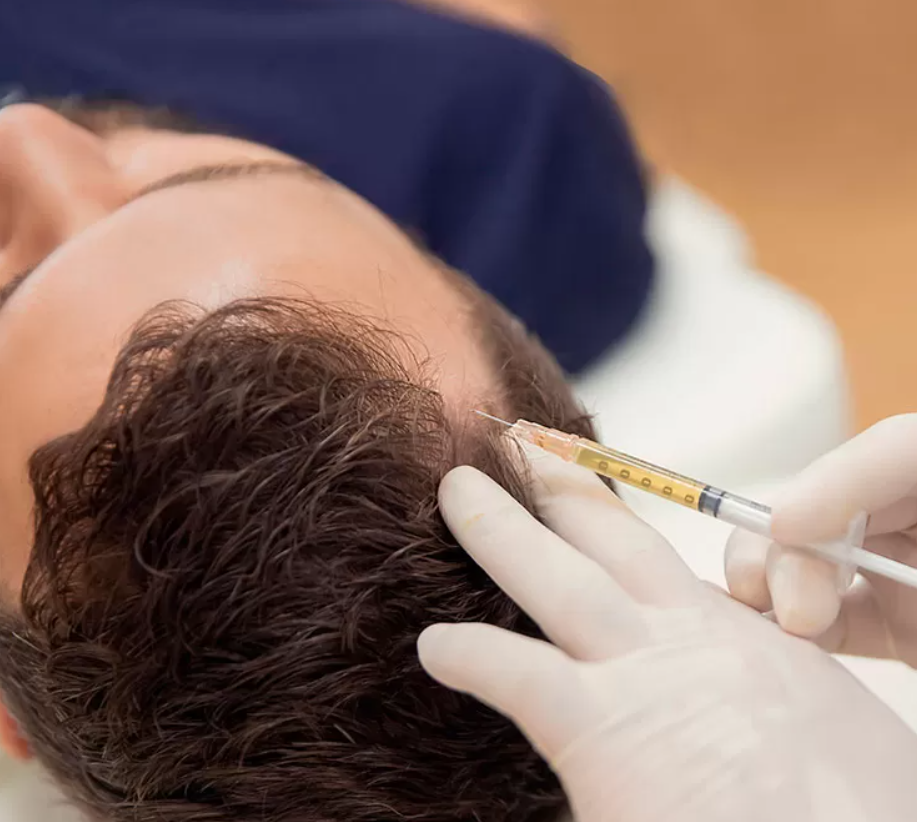 Discovering the Beauty of PRP in Beverly Hills